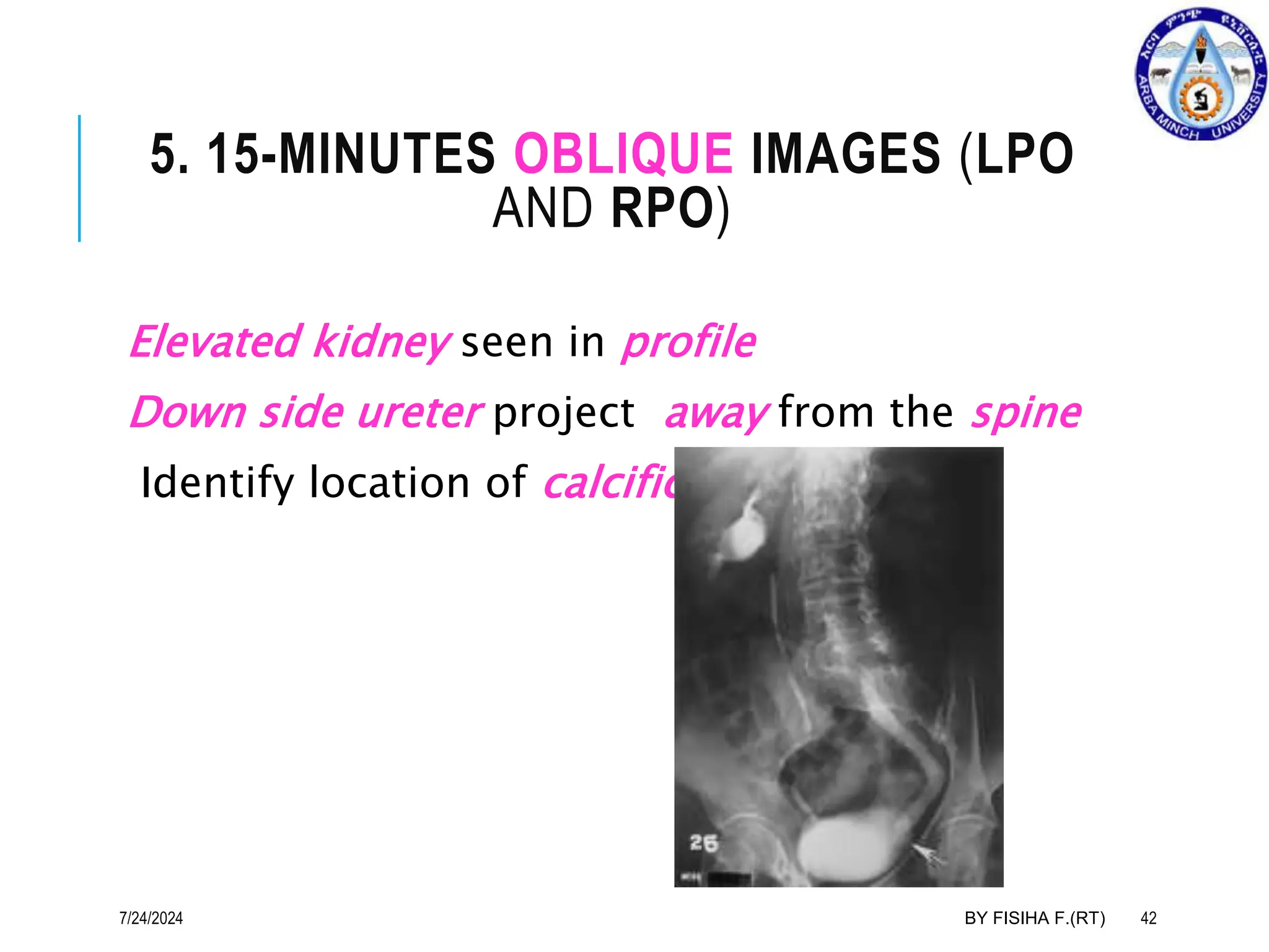 Unit-2 Special Radiographic Procedure of the urinary system-Fisiha F.(RT).ppt