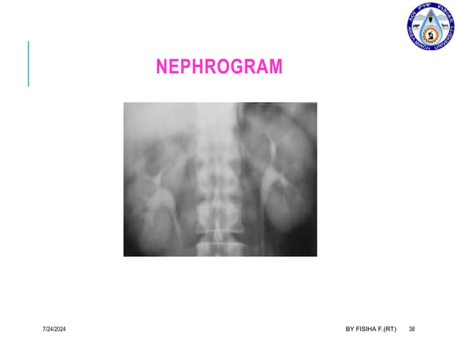 Unit-2 Special Radiographic Procedure of the urinary system-Fisiha F ...