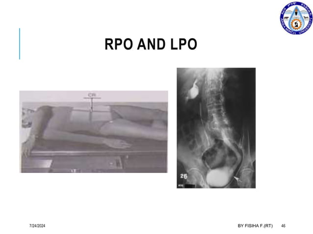Unit-2 Special Radiographic Procedure of the urinary system-Fisiha F.(RT).ppt