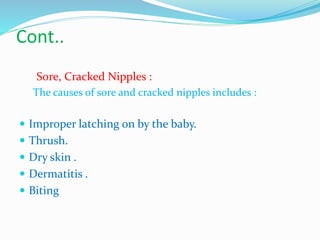 Unit-4C Brest Feeding.pptx