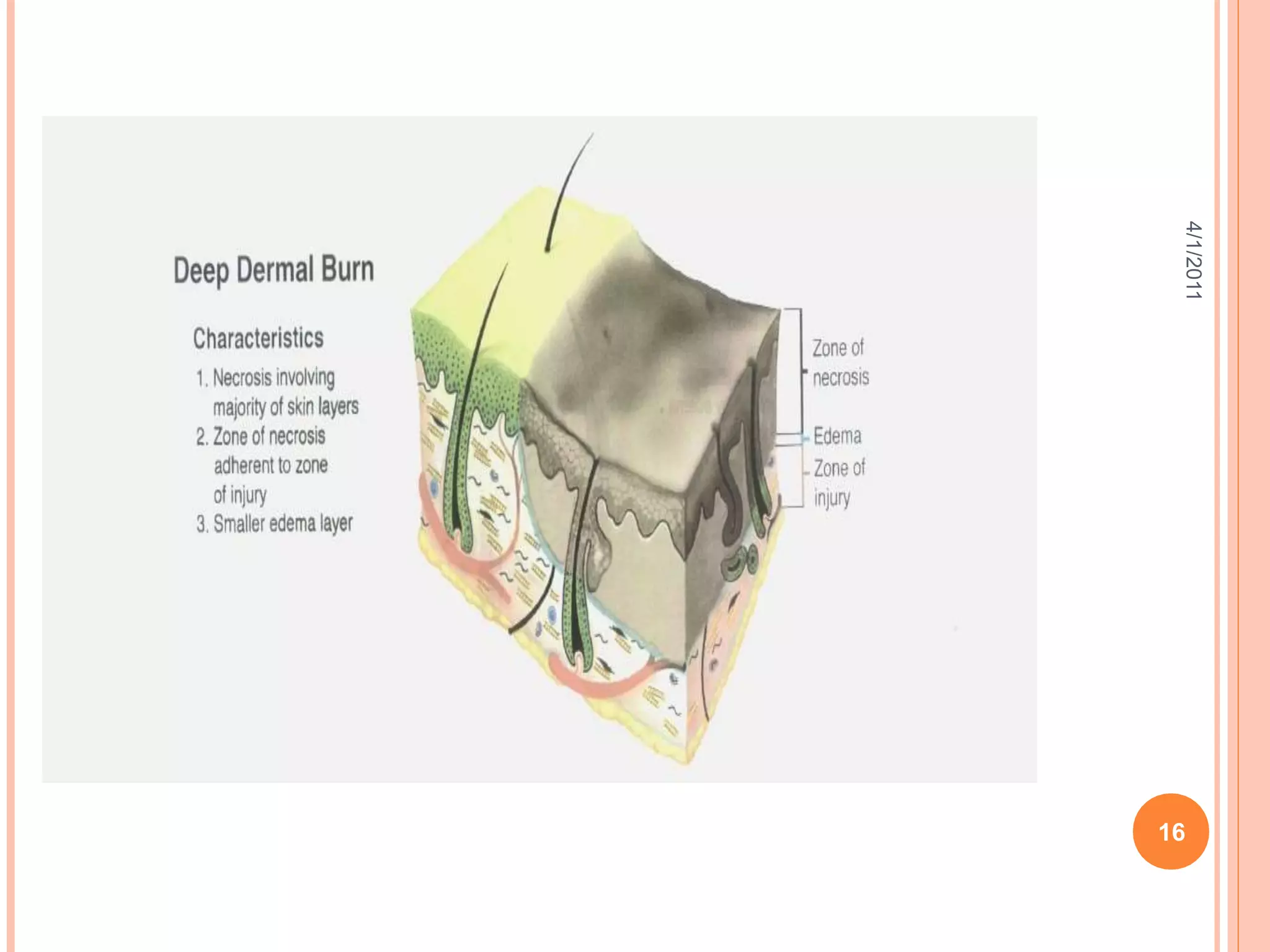 Burns & cosmetic surgery | PPTX
