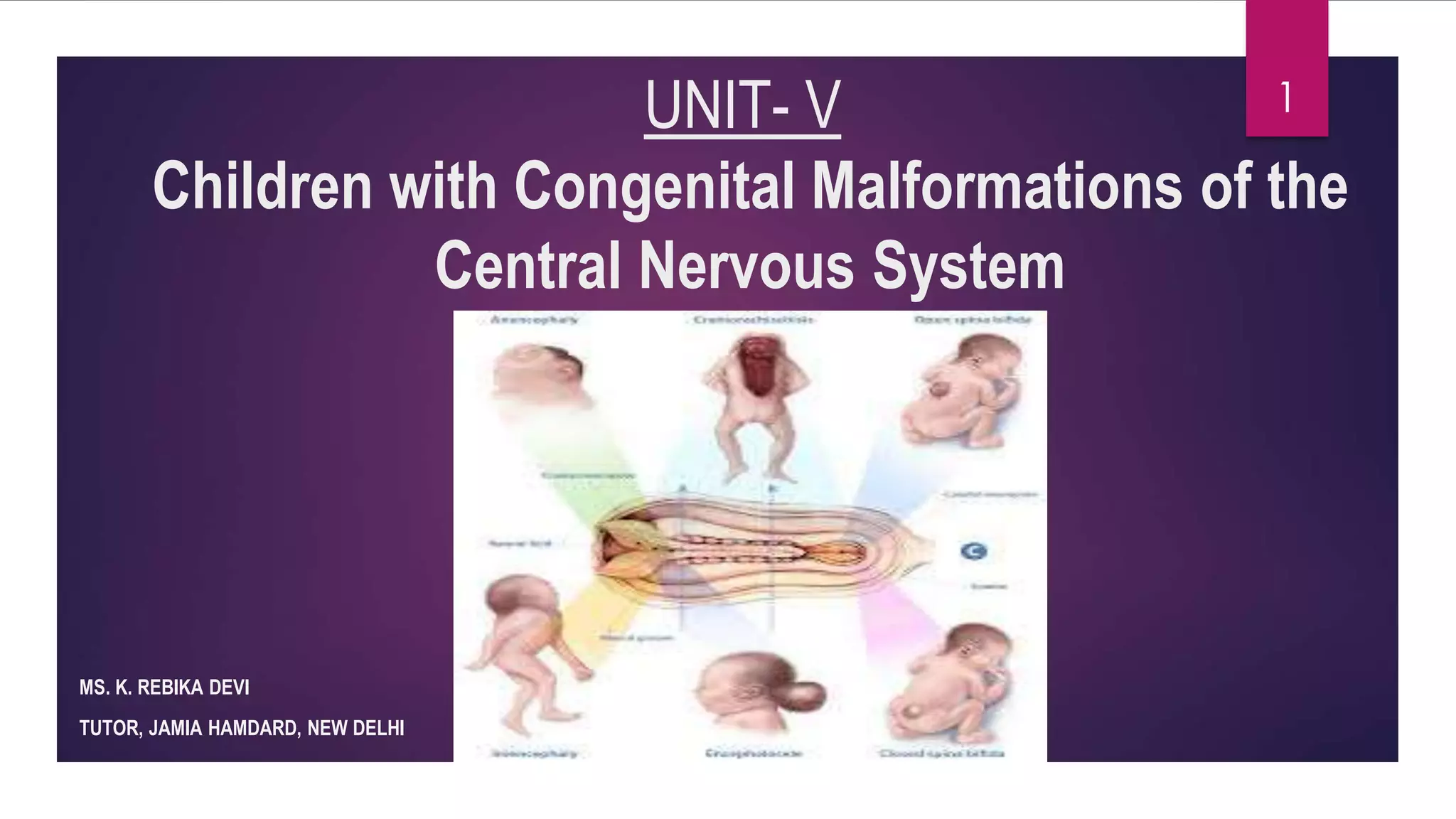 Congenital malformations of the central nervous system | PDF