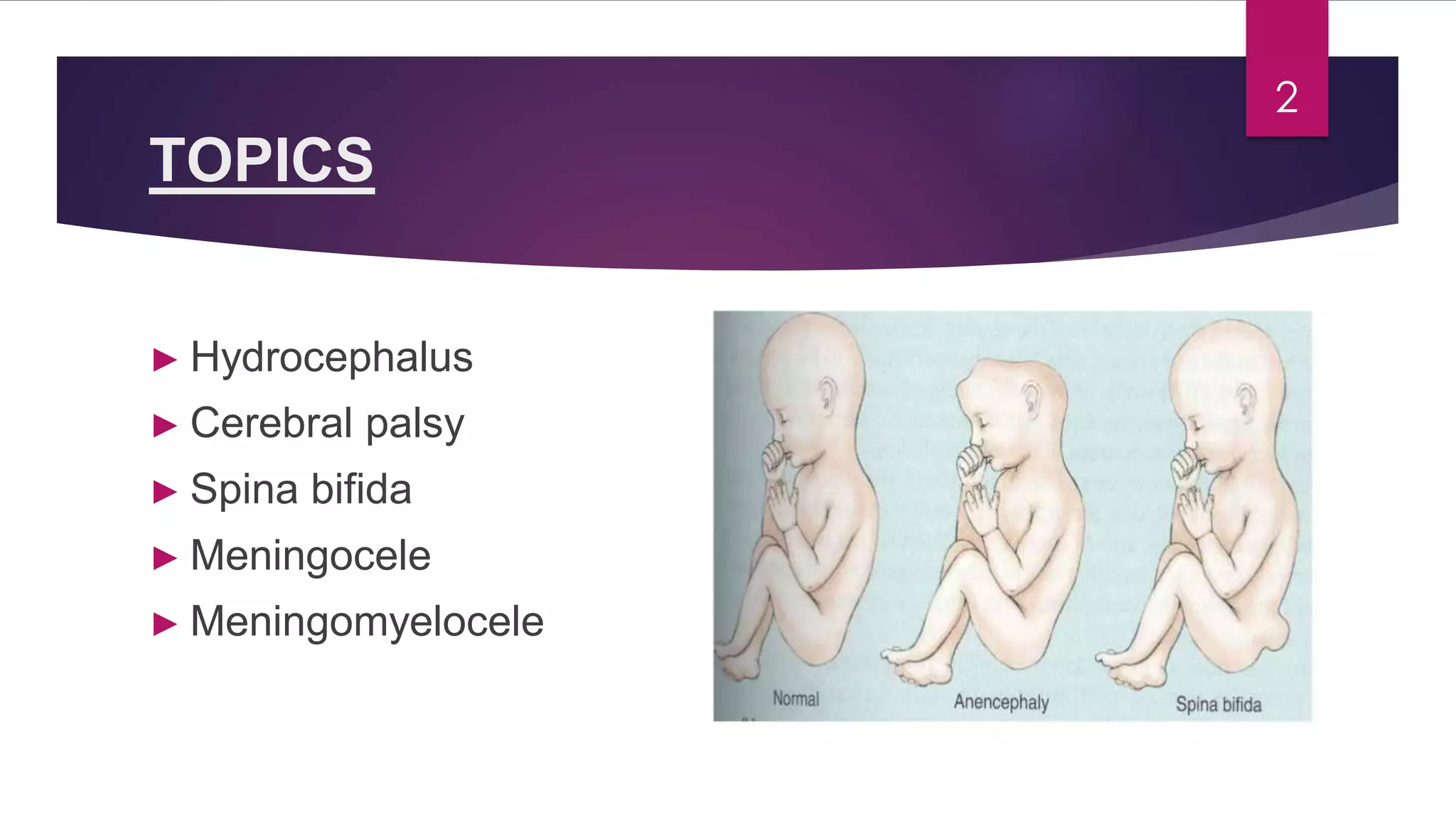 Congenital malformations of the central nervous system | PDF