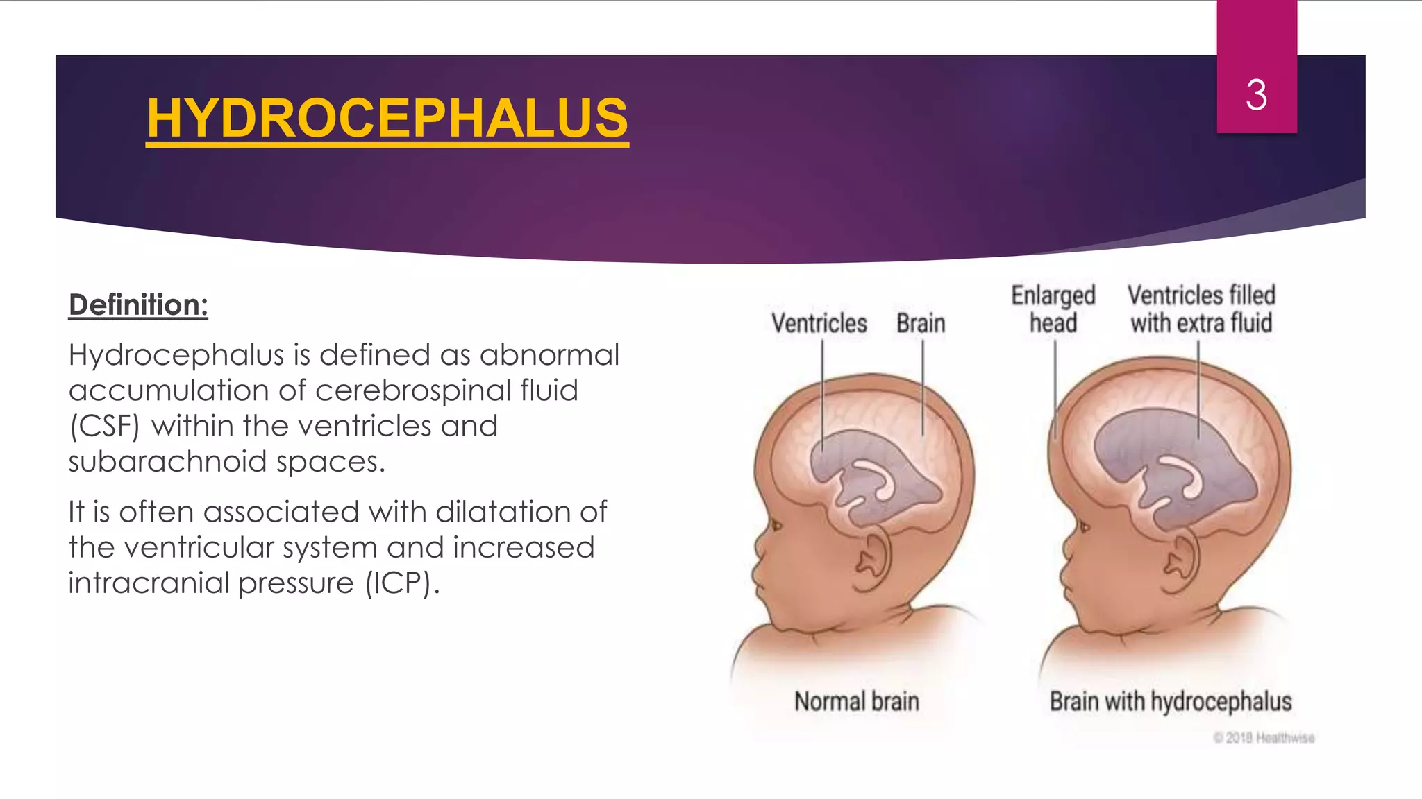 Congenital malformations of the central nervous system | PDF