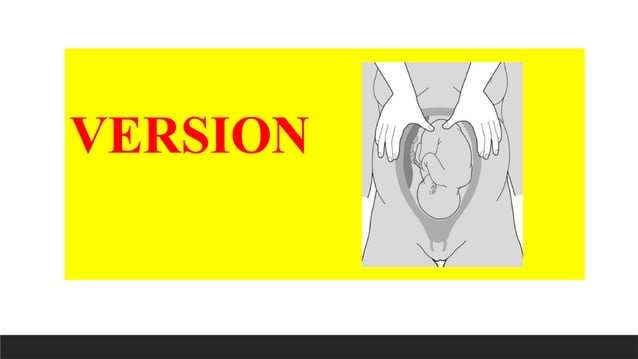 for GNM CLASSES UNIT-XII Obstetric Operation.pptx