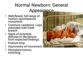 Unit 02 (B) Assessment of Newborn.pdf....... | PDF