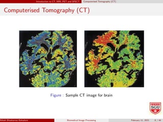 Introduction to Medical Image Processing | PDF