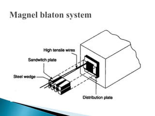 Unit 1 anchorage systems | PPTX