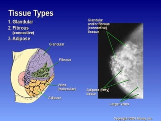 unit1-breastanatomyandphysiology-170811093651.pdf