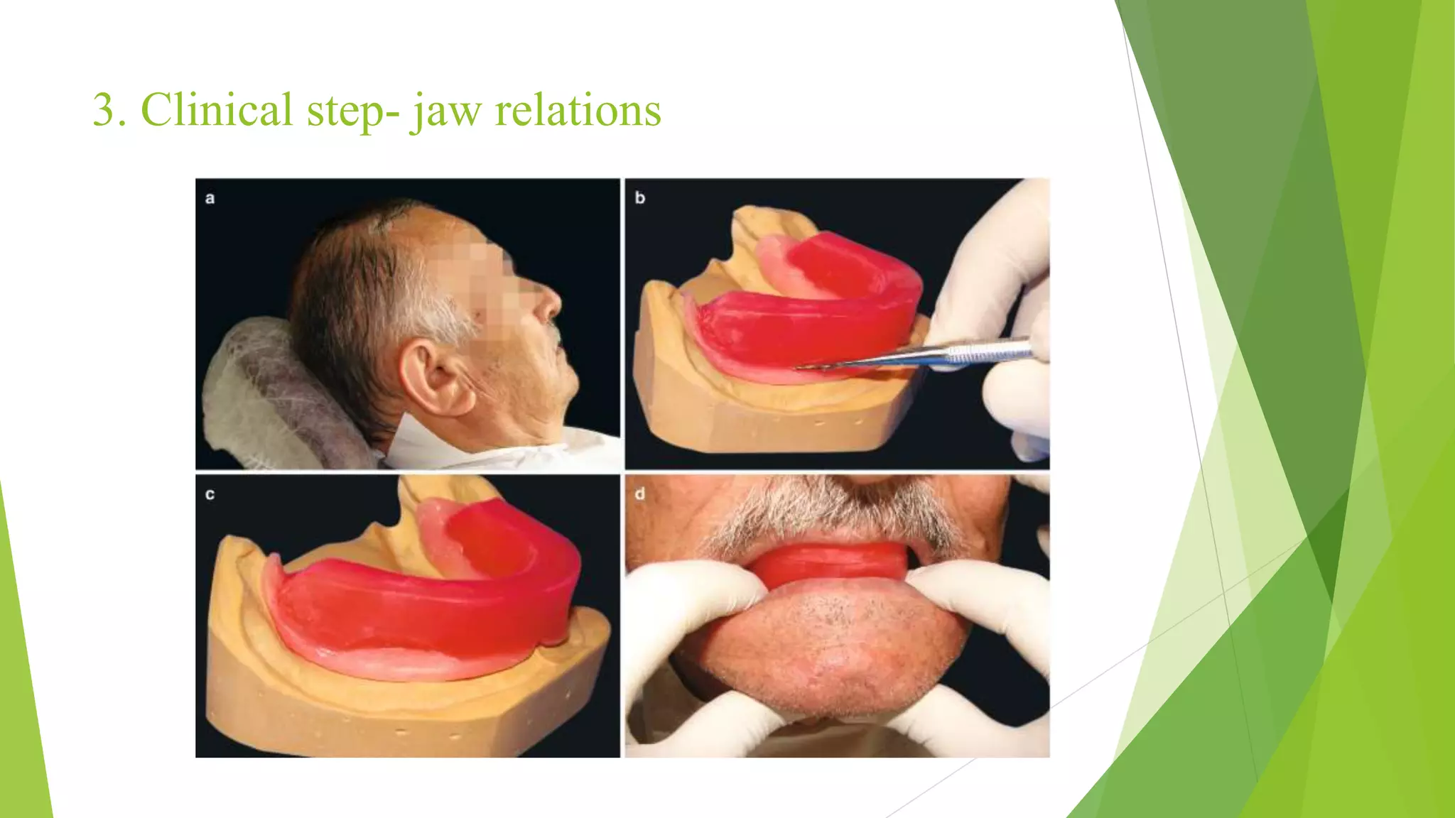 Introduction to Complete Denture.pptx