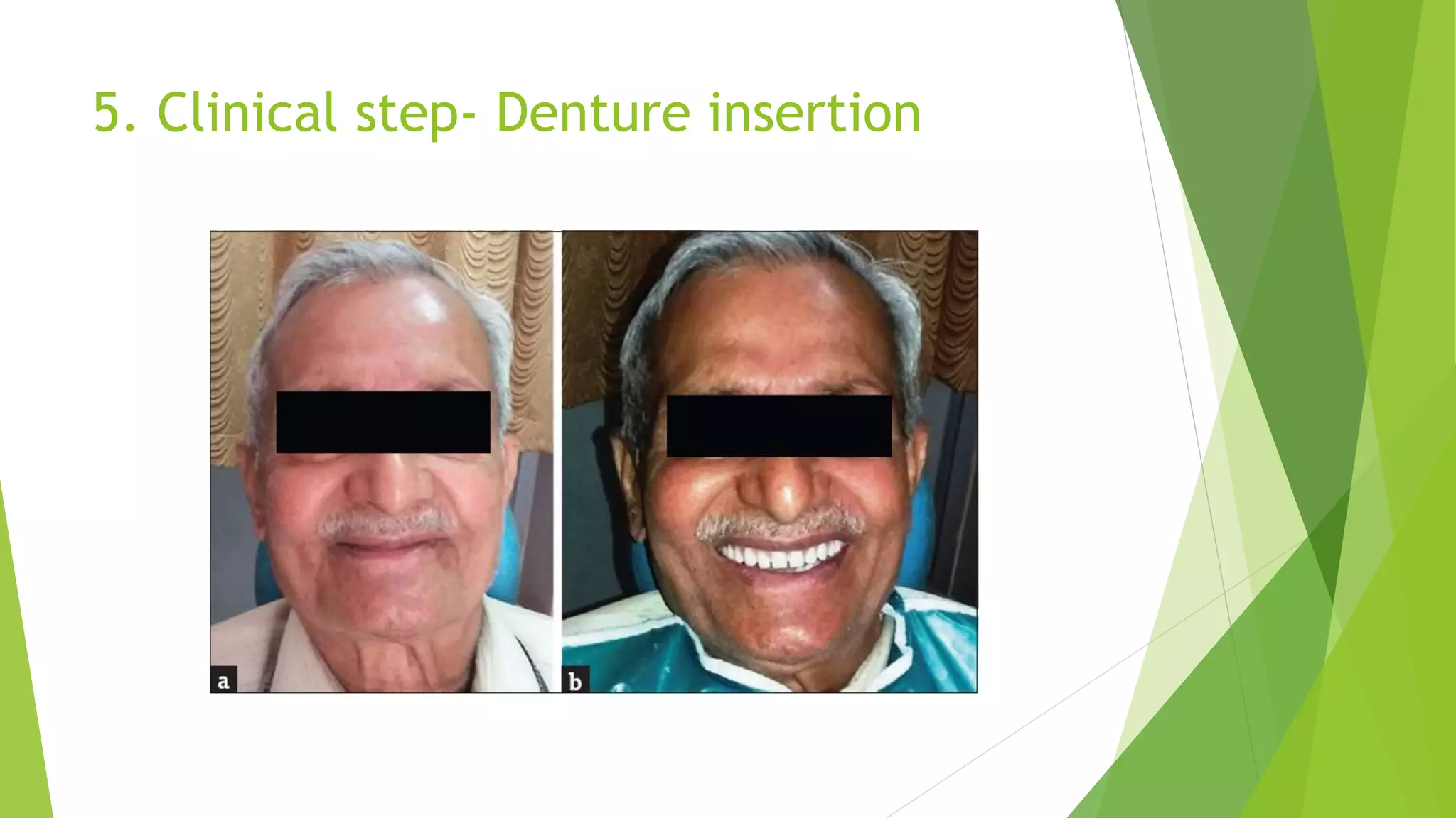Introduction to Complete Denture.pptx
