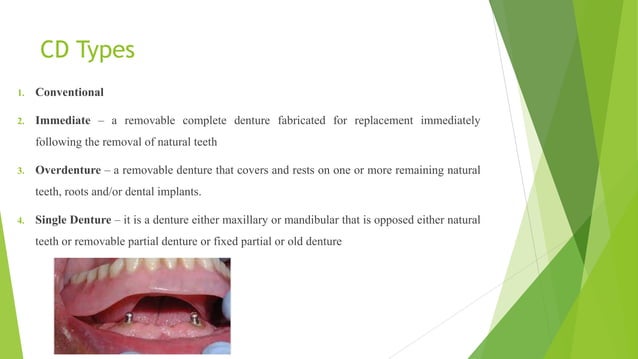 Introduction to Complete Denture.pptx