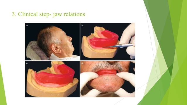 Introduction to Complete Denture.pptx