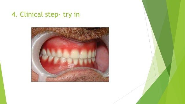 Introduction to Complete Denture.pptx