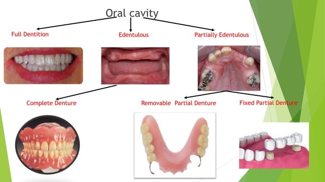 Introduction to Complete Denture.pptx