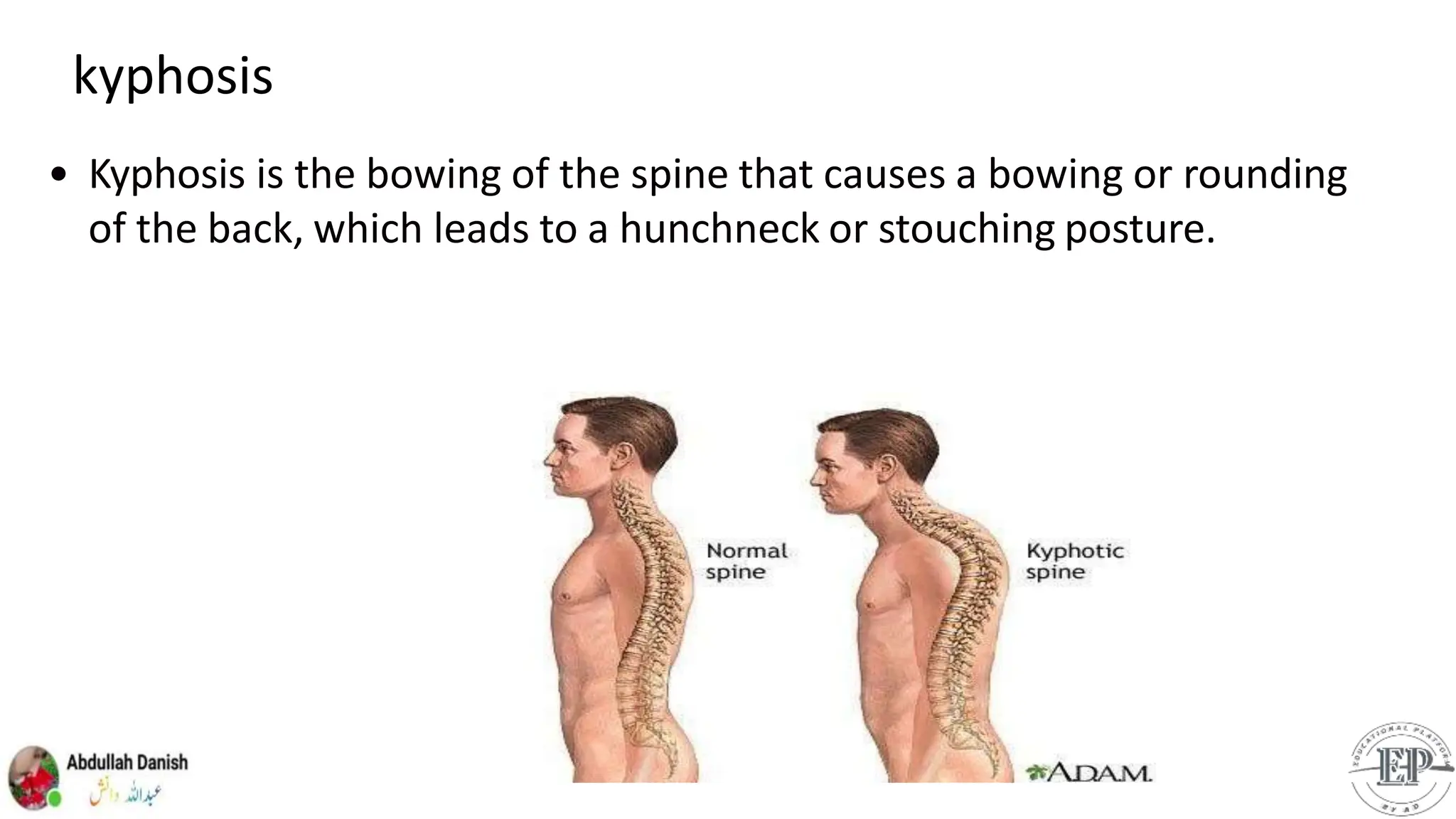 Unit 14; Musculo-skeletal dysfunctions in Children.pptx