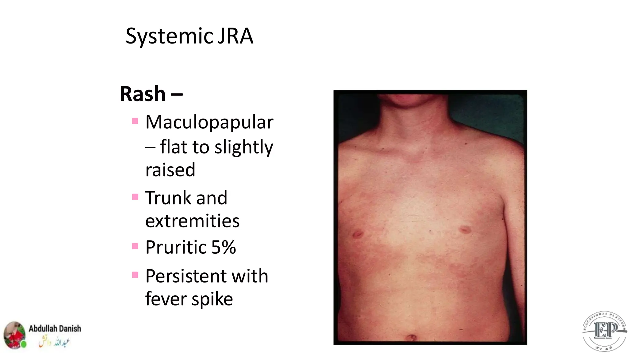 Unit 14; Musculo-skeletal dysfunctions in Children.pptx
