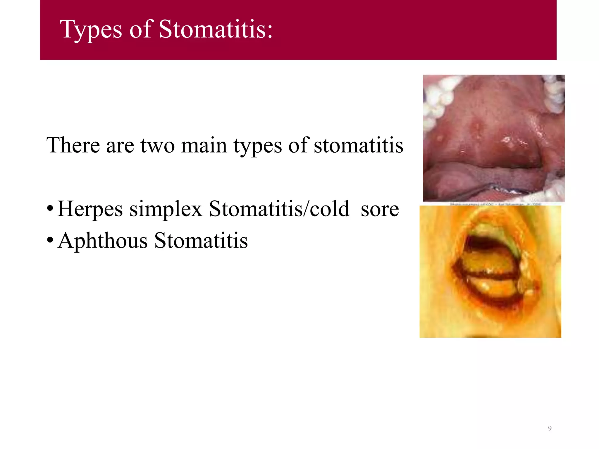 Unit 1; Gastro-Intestinal Disorders By Nursing Tutor-2.pptx