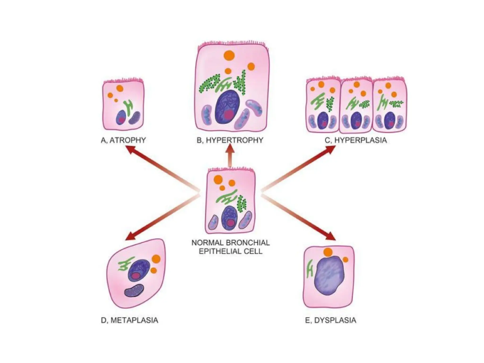 Basic Principles of Cell Injury and Adaptation | PPTX