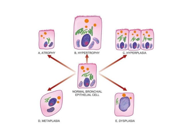 Basic Principles of Cell Injury and Adaptation | PPTX | Chemistry | Science