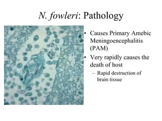 unit_2.2.free_living_amoeba..ppt