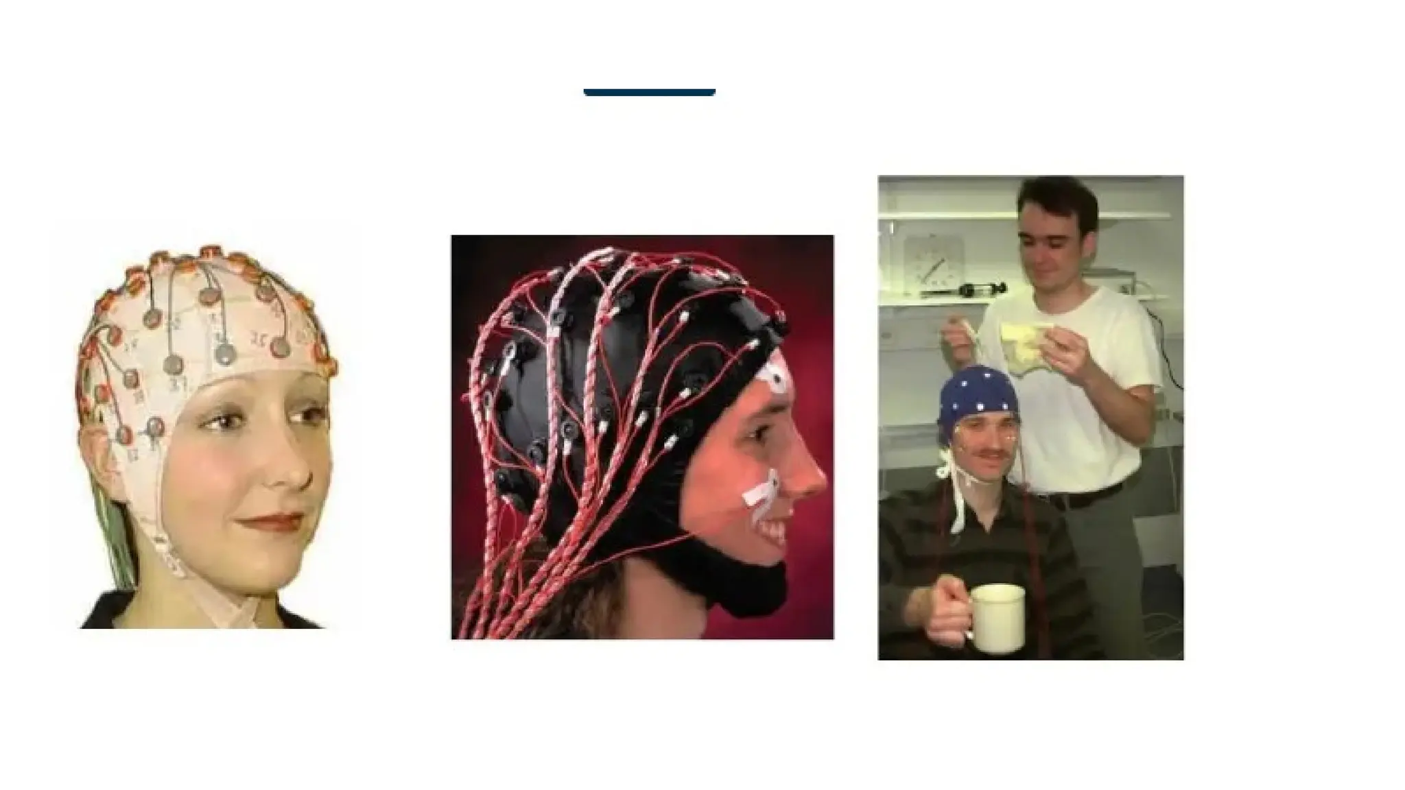 biopotential electrodes for EEG, ECG and EMG | PPTX