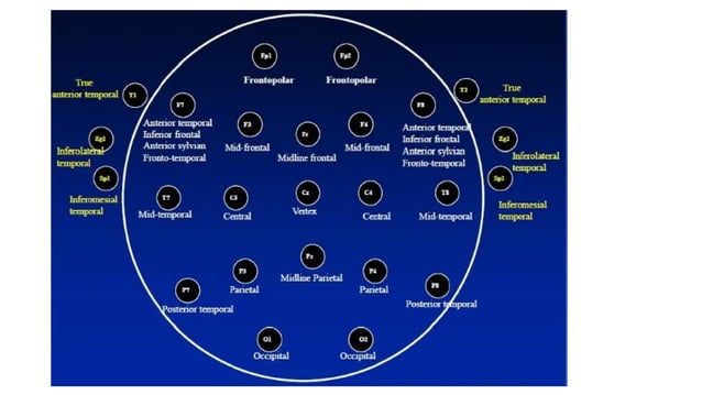 biopotential electrodes for EEG, ECG and EMG | PPT