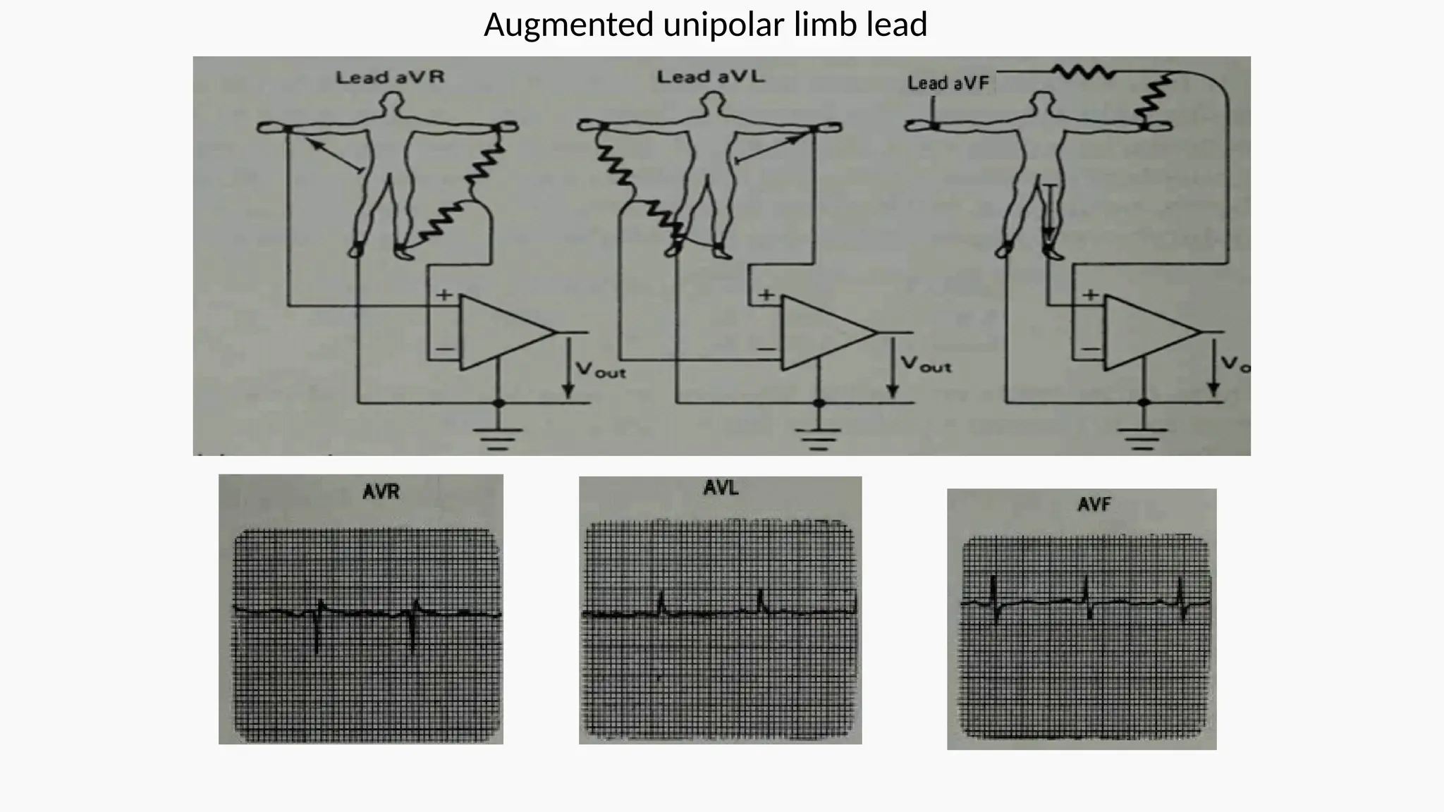 BIOPOTENTIAL MEASUREMENT-ECG, EEG, EMG, PCG | PPTX