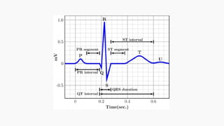 BIOPOTENTIAL MEASUREMENT-ECG, EEG, EMG, PCG | PPTX