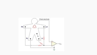 BIOPOTENTIAL MEASUREMENT-ECG, EEG, EMG, PCG | PPTX