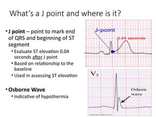 Cardiac Conduction and basic rhythm understanding | PPTX
