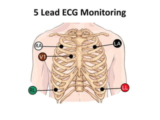 Cardiac Conduction and basic rhythm understanding | PPTX