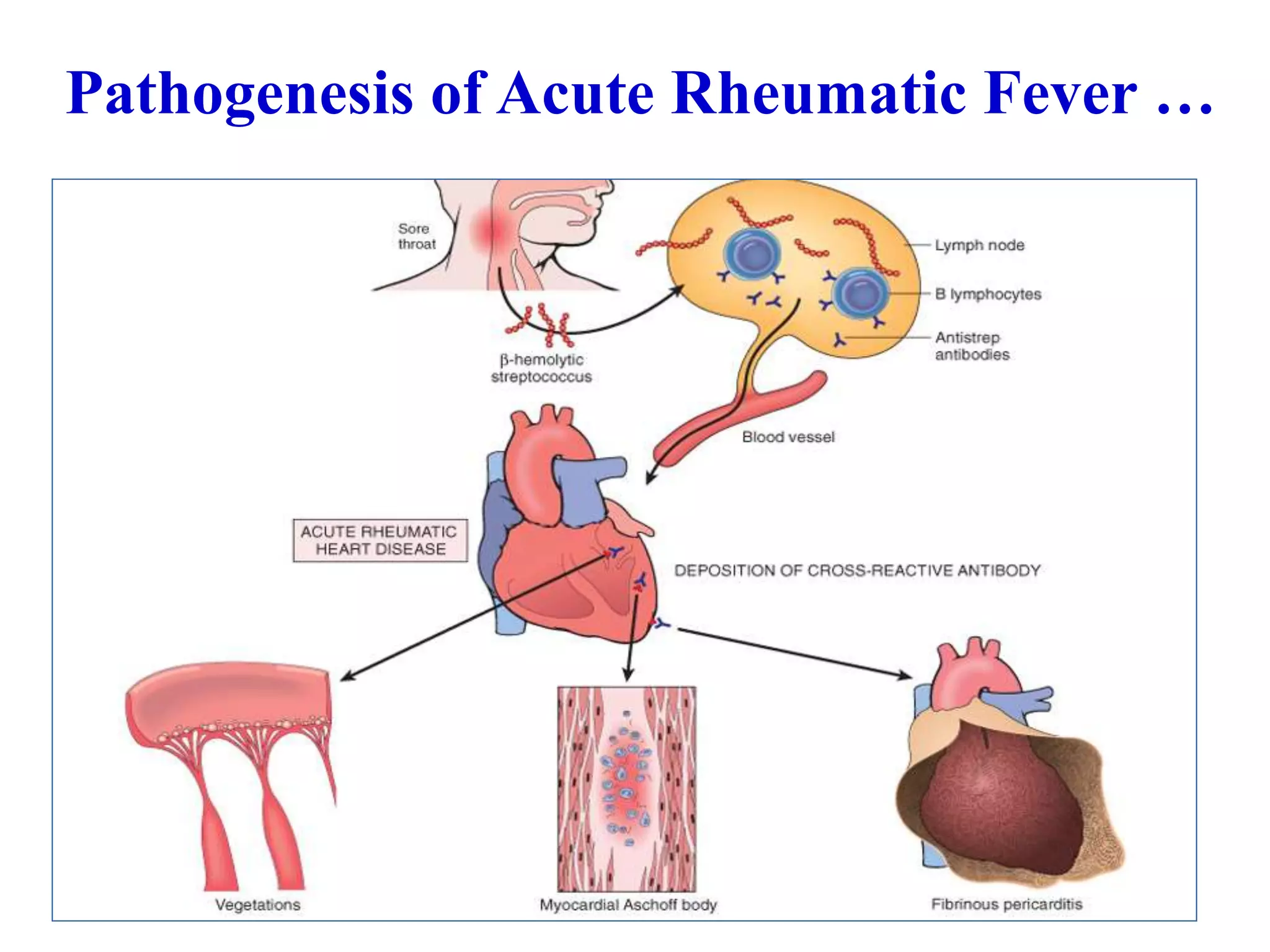 Unit 2_Acute Rheumatic Fever.pptx