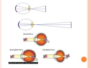 Elements of Visual Perceptions Structure | PPTX | Eye and Vision Conditions | Diseases and ...