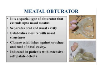 Unit 2 Obturators.pptx