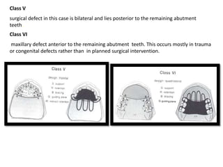 Unit 2 Obturators.pptx