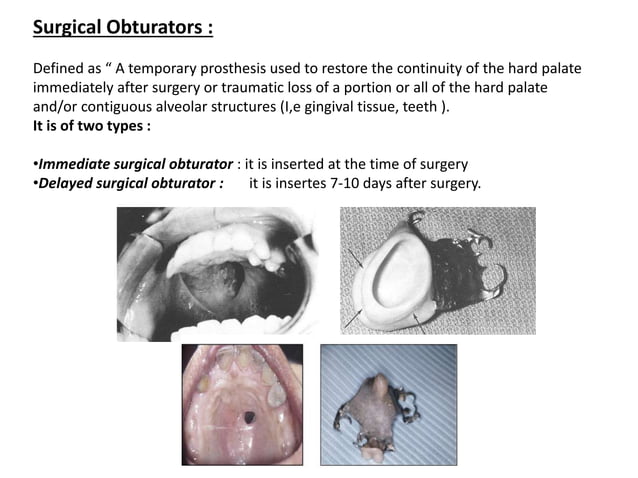 Unit 2 Obturators.pptx