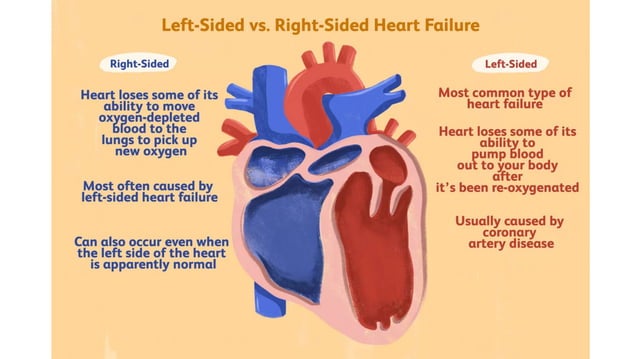 Unit 2 Pathophysiology. Cardiovascular Diseases | PPTX