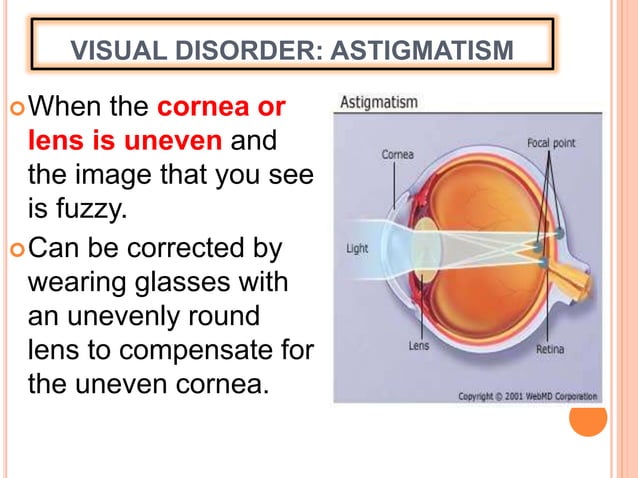 UNIT 2 SENSE ORGANS EYES.pptx