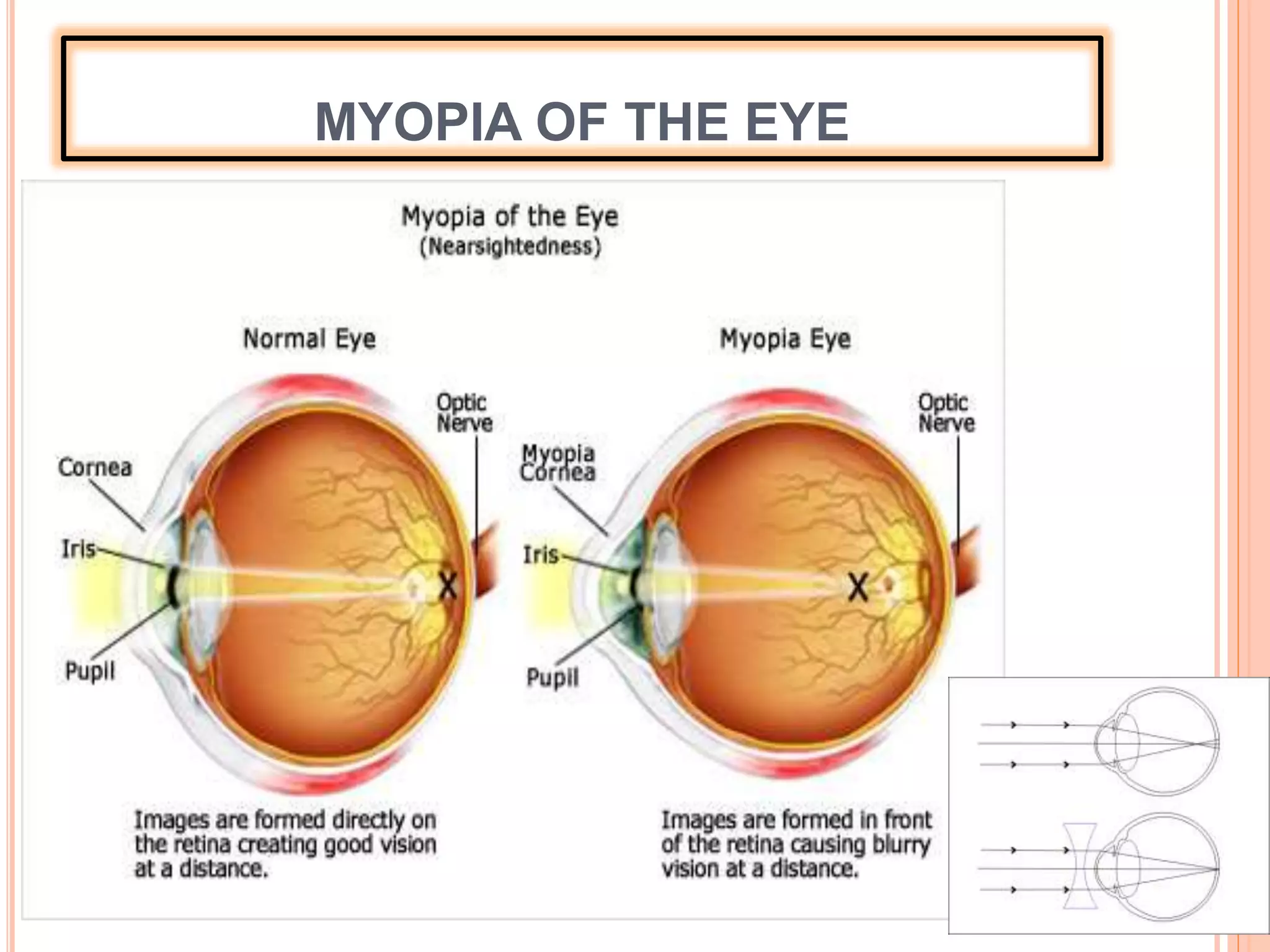 Unit 2 sense organs eyes skin and tongue(1) | PPT