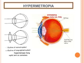 Unit 2 sense organs eyes skin and tongue(1) | PPTX | Eye and Vision ...