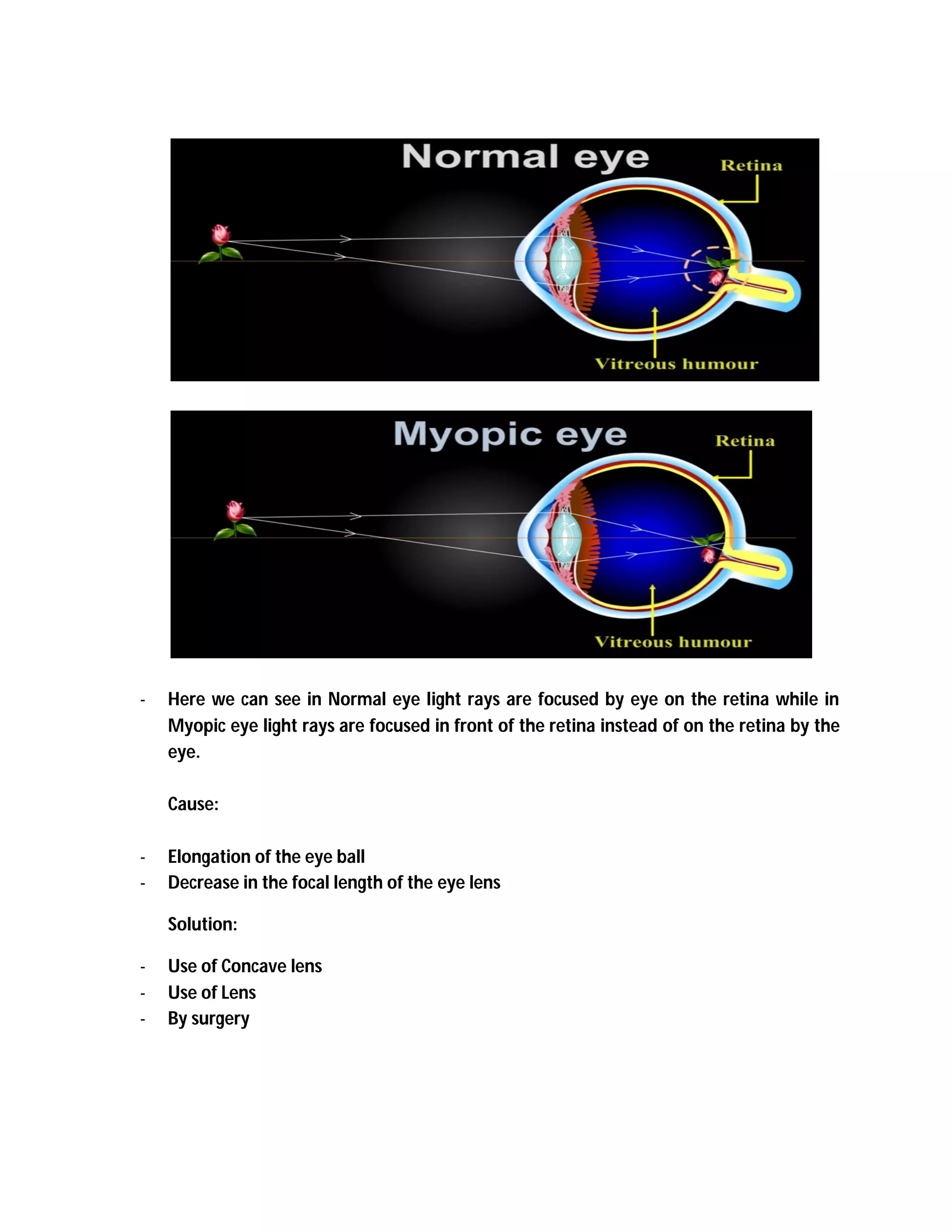 Ophthalmic & Geometrical, Physiological Optics | PDF