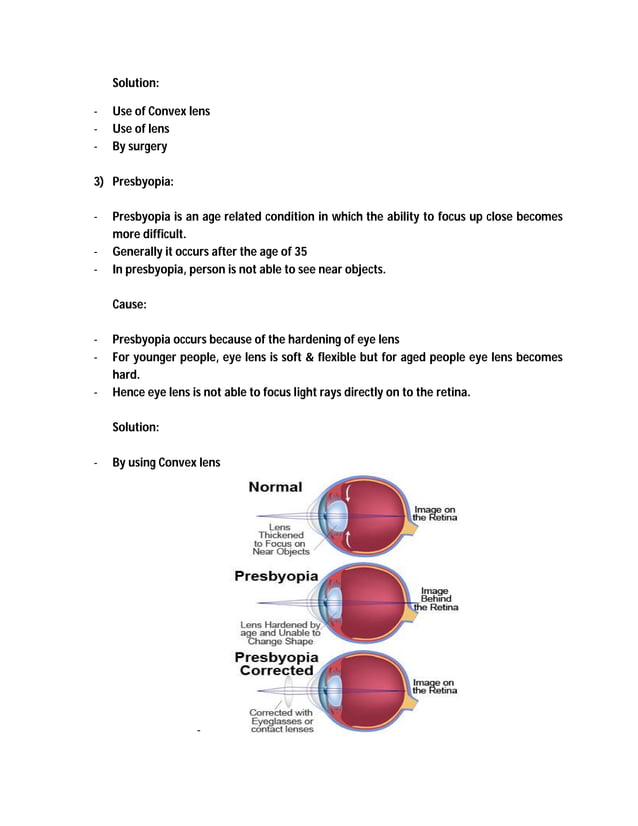 Ophthalmic & Geometrical, Physiological Optics | PDF