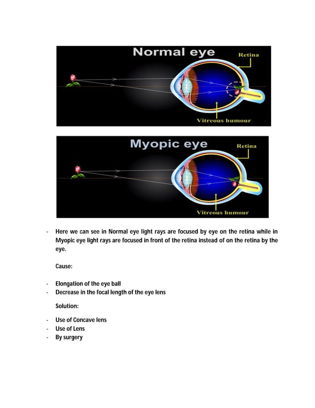Ophthalmic & Geometrical, Physiological Optics | PDF