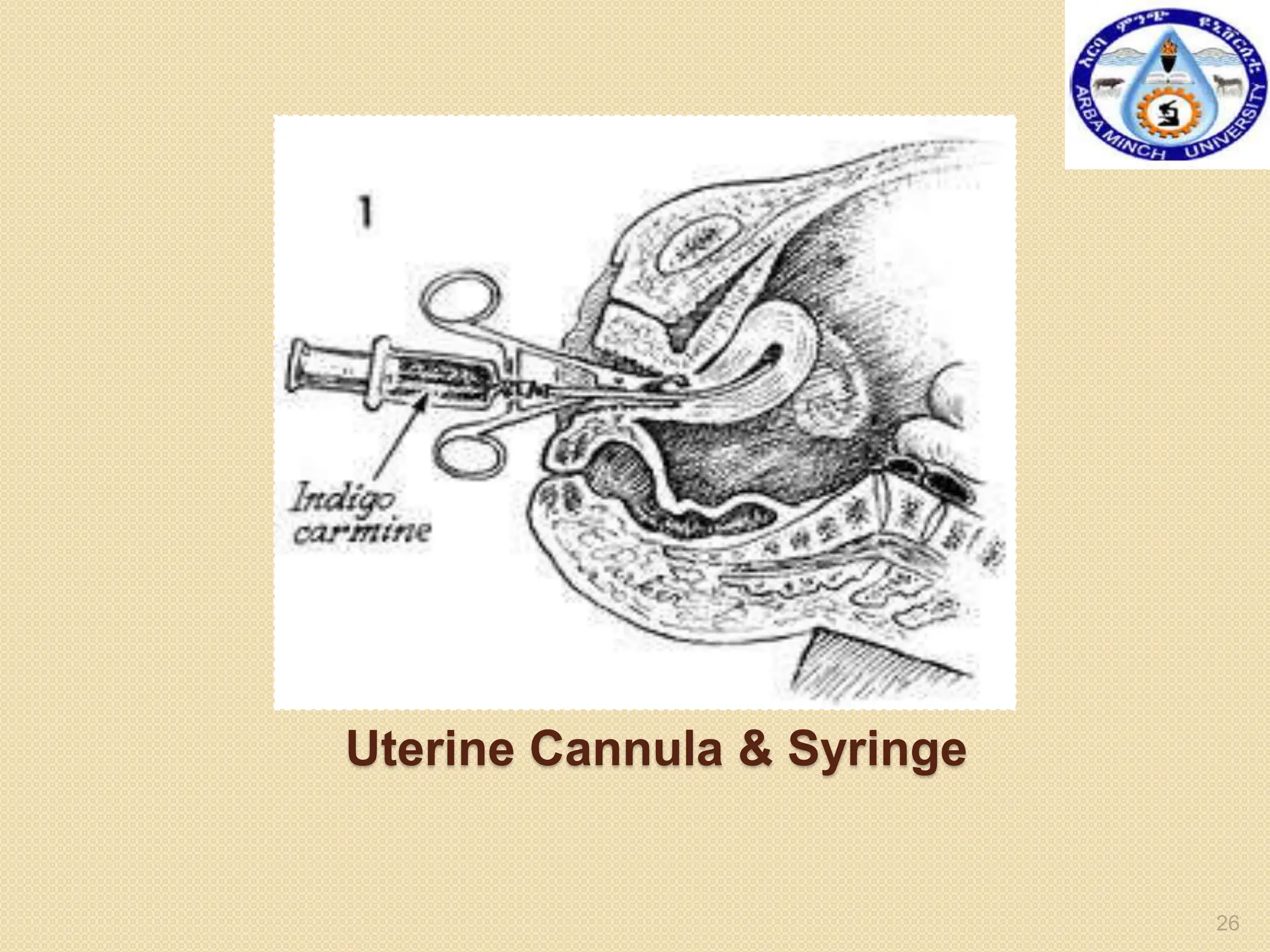 Special radiographic procedure -Hysterosalpingography.pptx