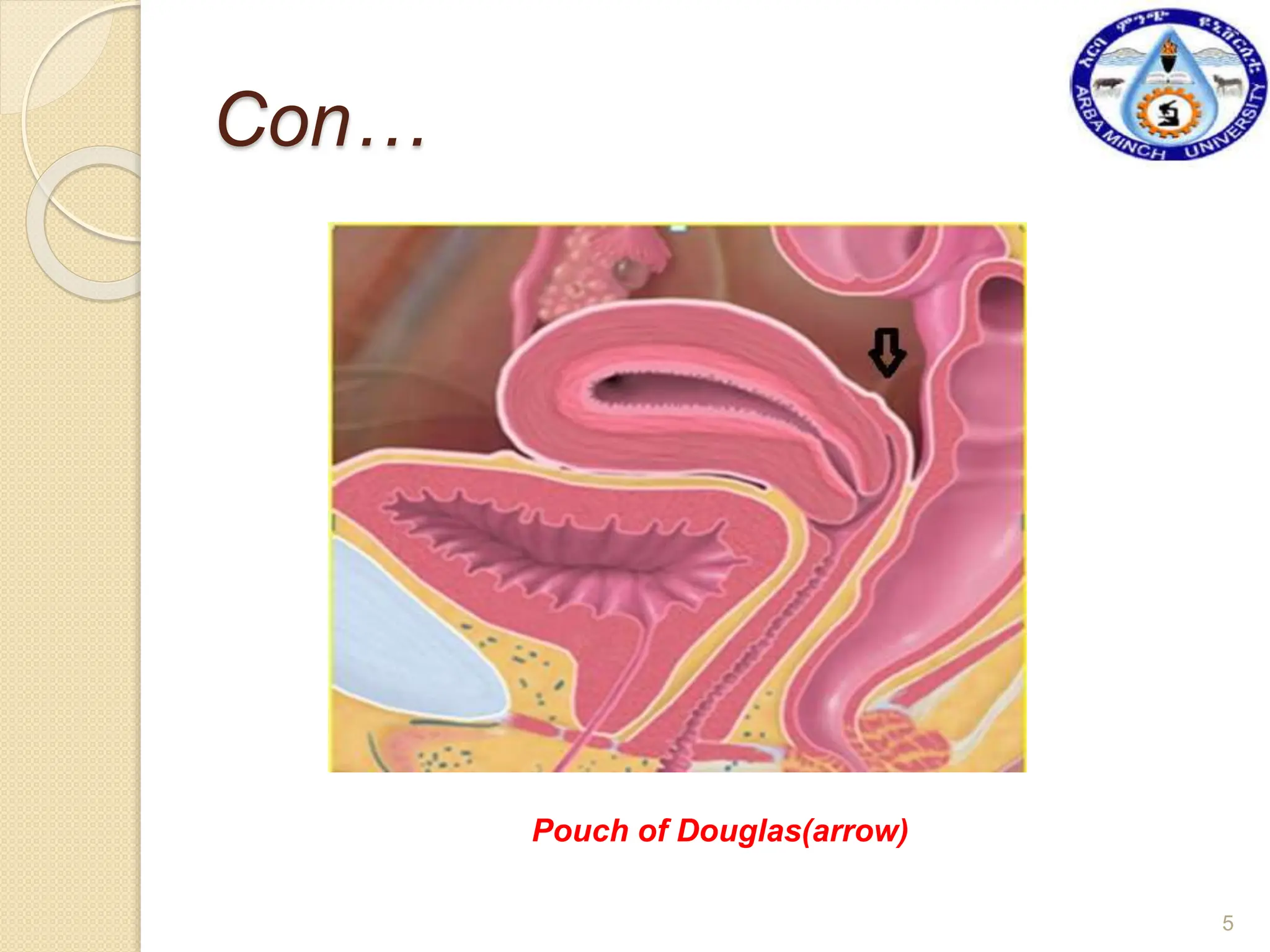Special radiographic procedure -Hysterosalpingography.pptx