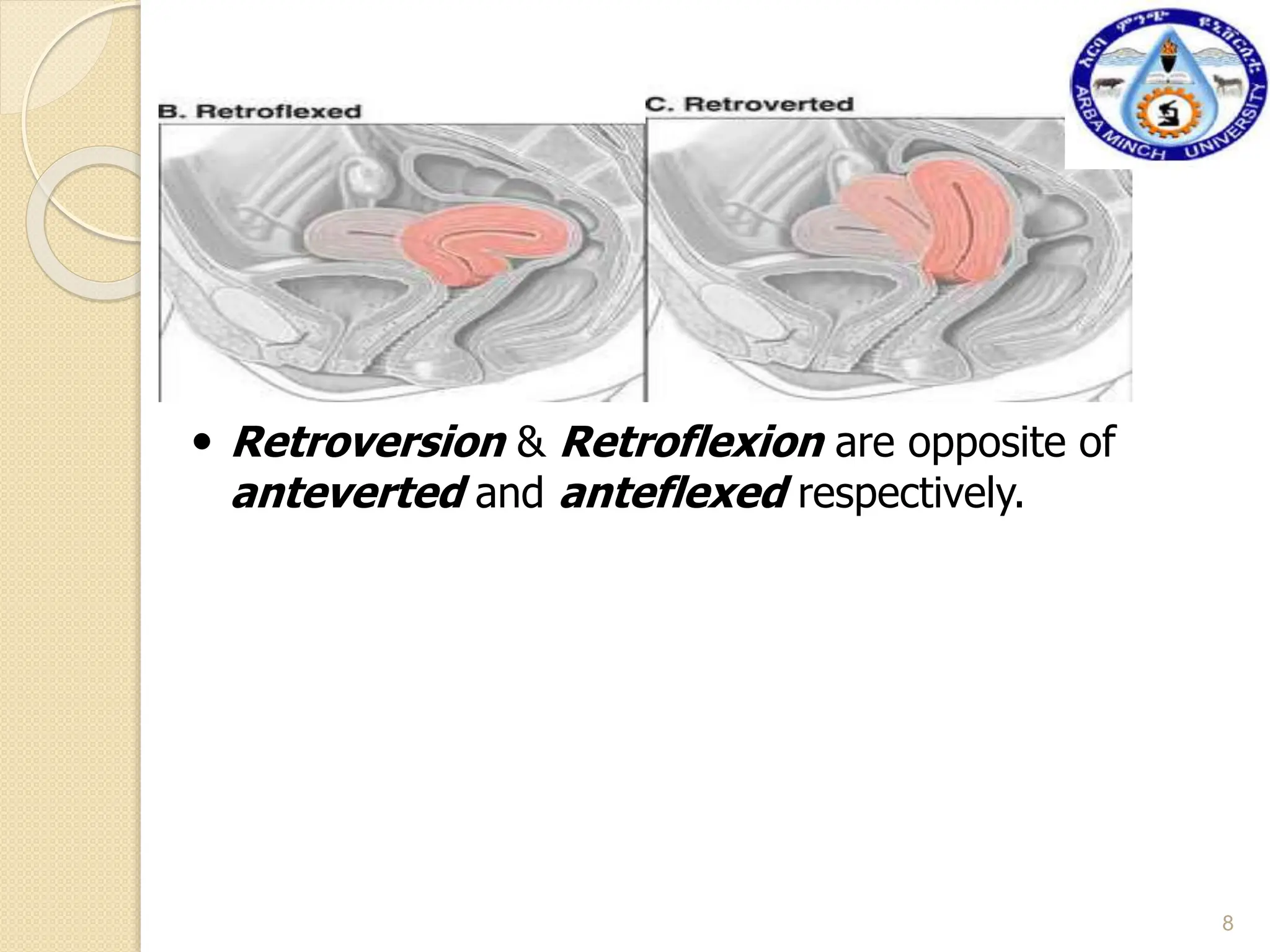 Special radiographic procedure -Hysterosalpingography.pptx