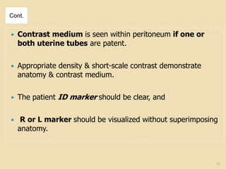 Special radiographic procedure -Hysterosalpingography.pptx