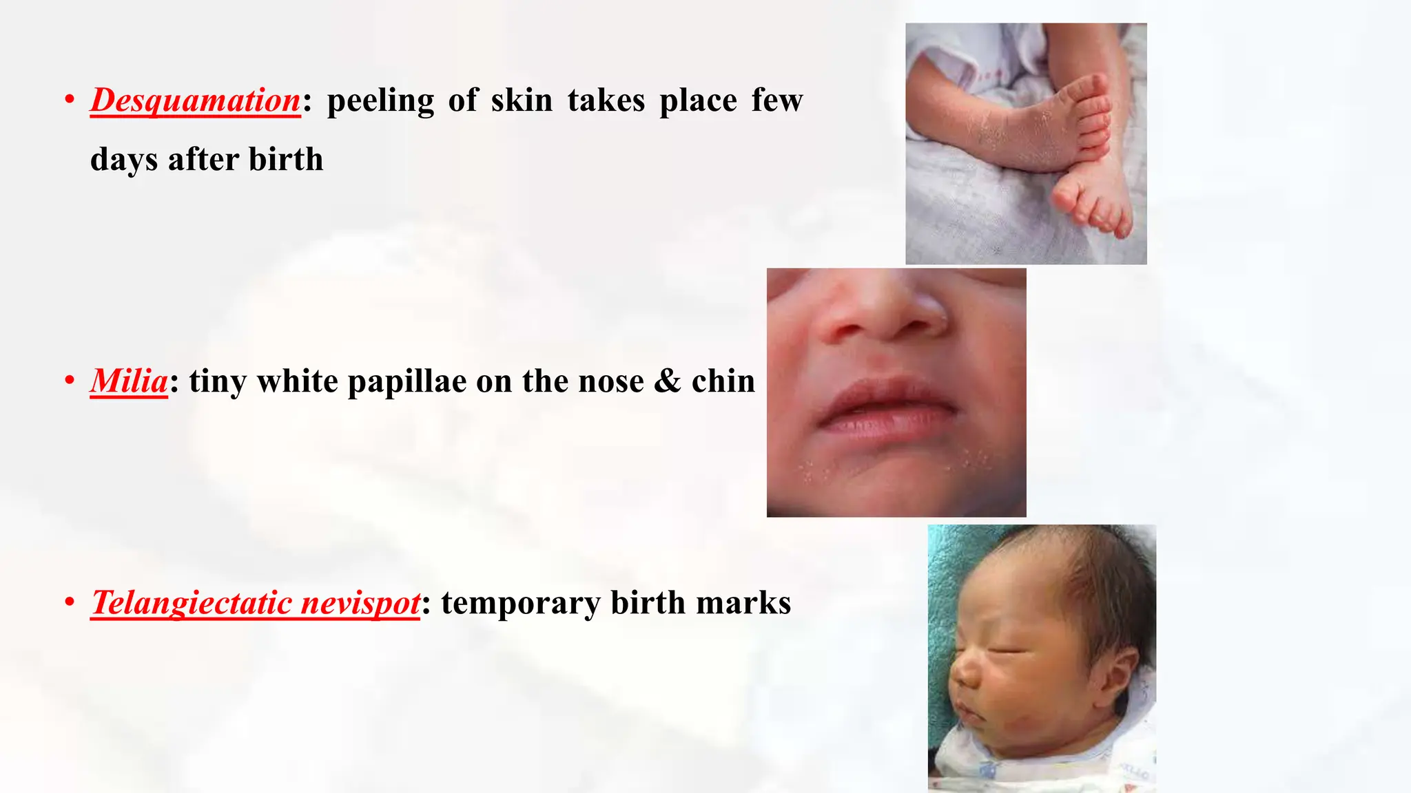 Unit III, Nursing care of a neonate PART 1.pptx | Pregnancy ...