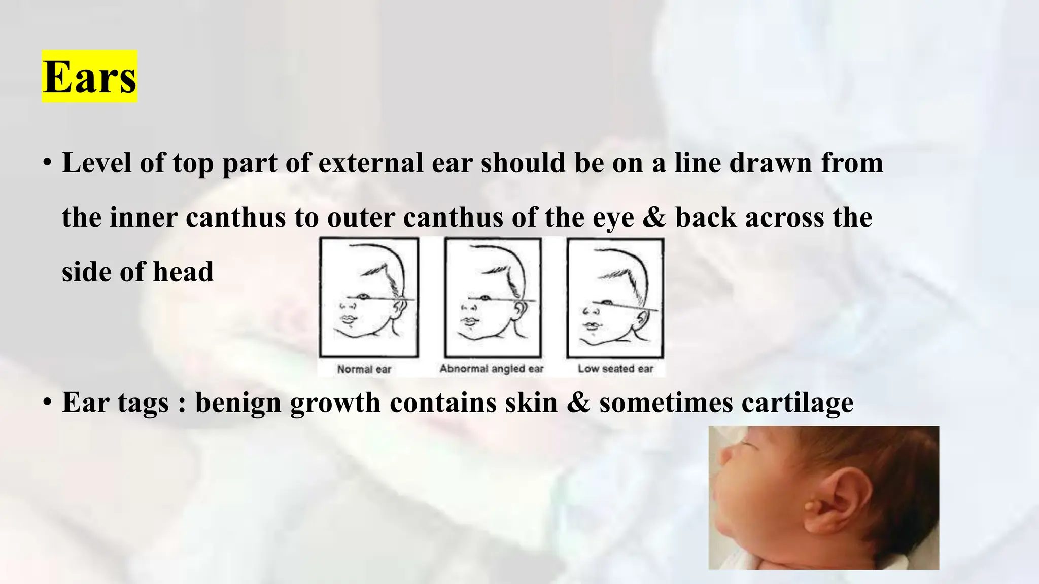 Unit III, Nursing care of a neonate PART 1.pptx
